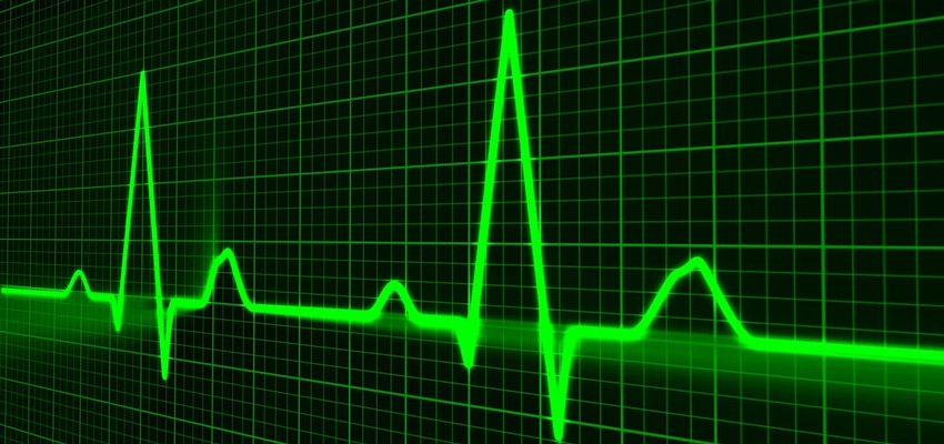 #Exclusivo Salud cardiovascular: estos son los altos costos de cuidar ...